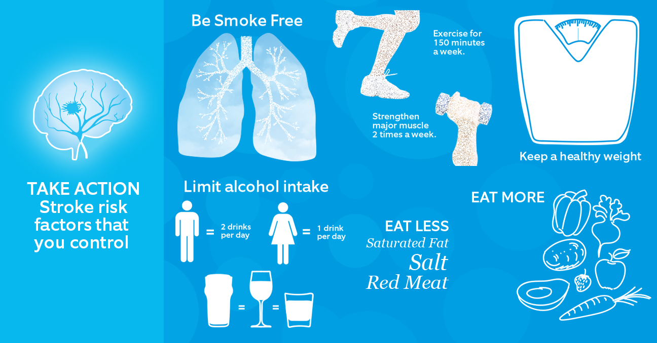 Stroke | Research & Clinical Trials | Burke Neurological Institute ...
